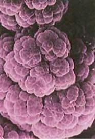 Permian mass extinction: was a humble microbe responsible? | Geological ...